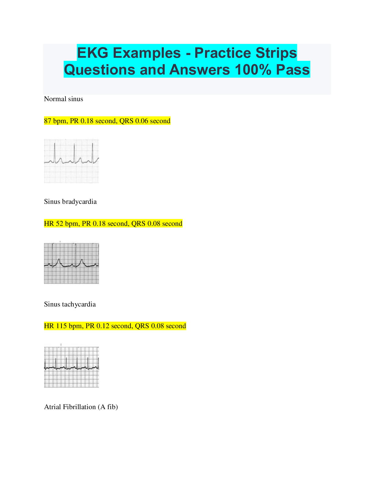 EKG Examples - Practice Strips Questions and Answers 100% Pass ...