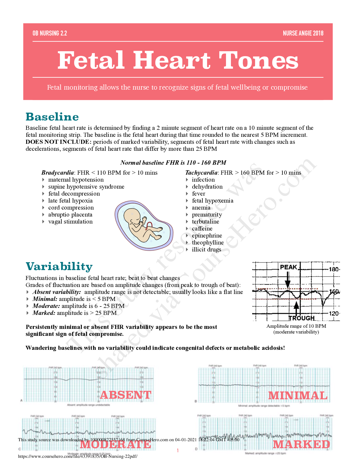 NURSING 101 OB_Nursing_2.2 Fetal Heart Tones - Scholarfriends