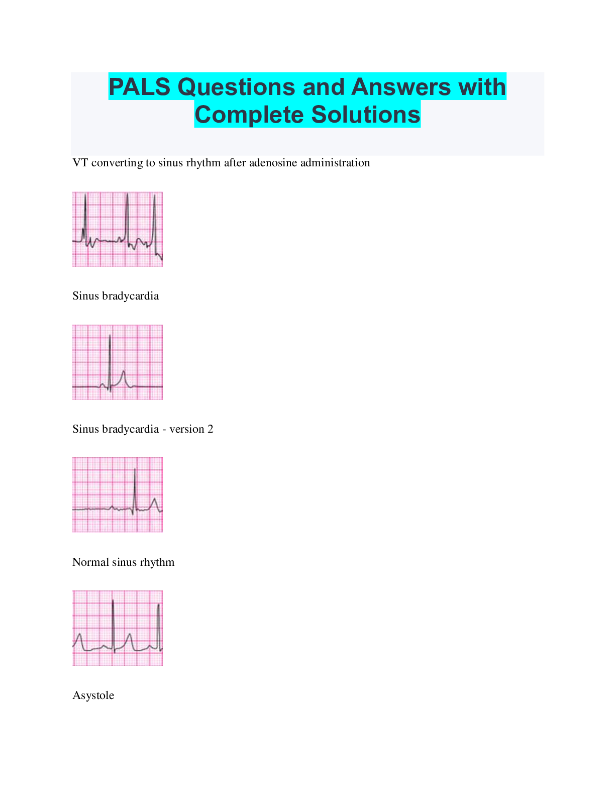 PALS Questions and Answers with Complete Solutions – Scholarfriends ...