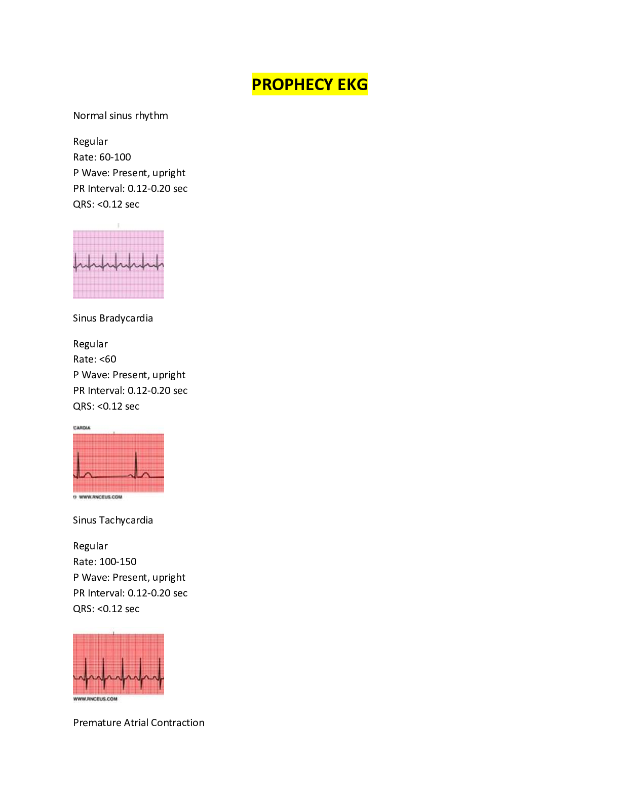 Prophecy EKG Questions And Answers 2022/2023 - Scholarfriends